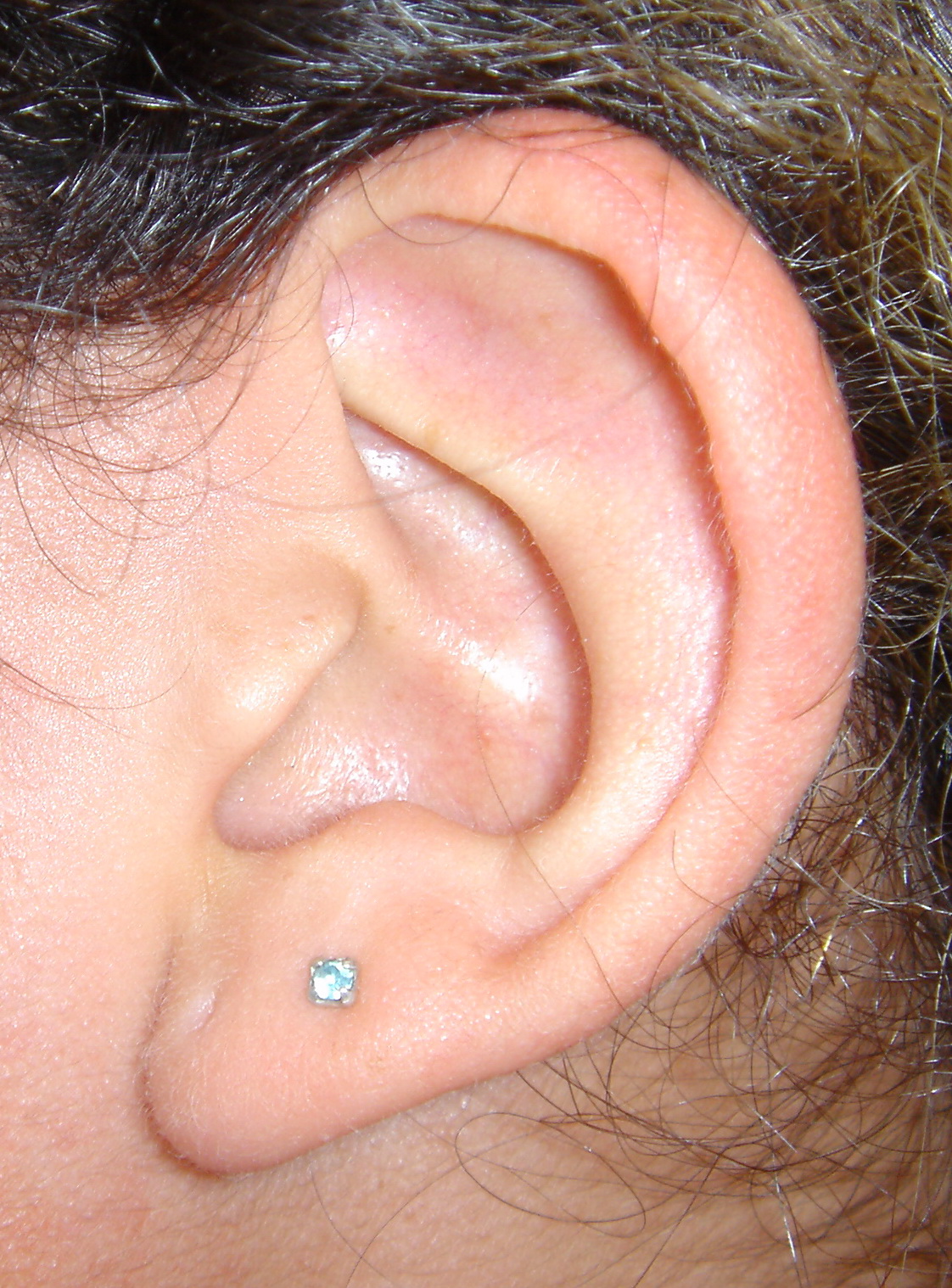 Service d'ORL et chirurgie cervico-faciale de l'Hôpital Robert Debré ...